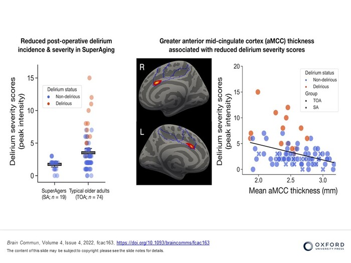 SuperAgers jsou odolnější vůči rozvoji deliria :: superstarnuti.cz